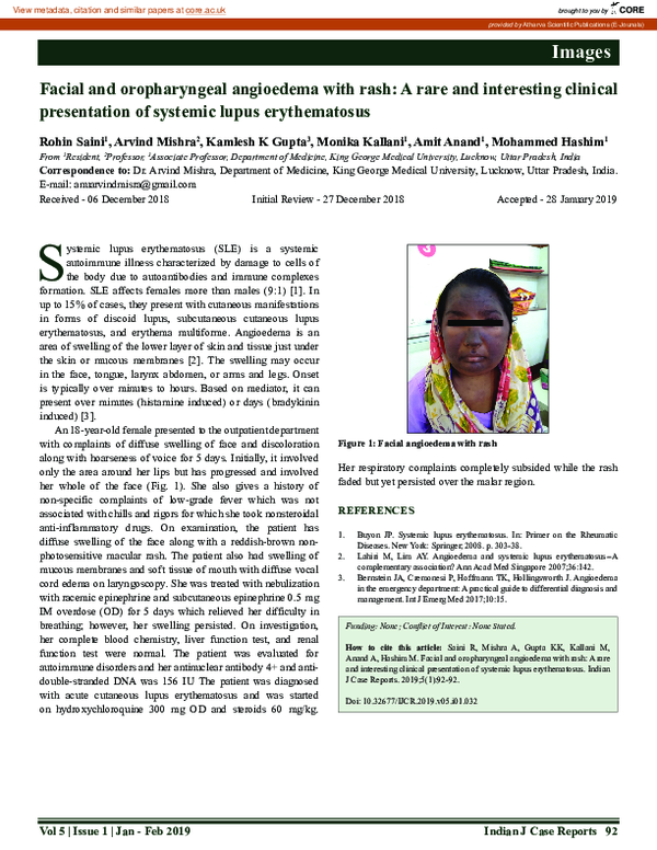 Pdf Facial And Oropharyngeal Angioedema With Rash A Rare And Interesting Clinical