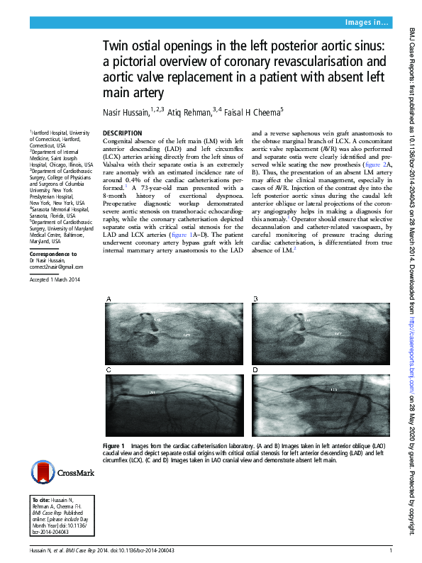 (PDF) Twin ostial openings in the left posterior aortic sinus: a ...