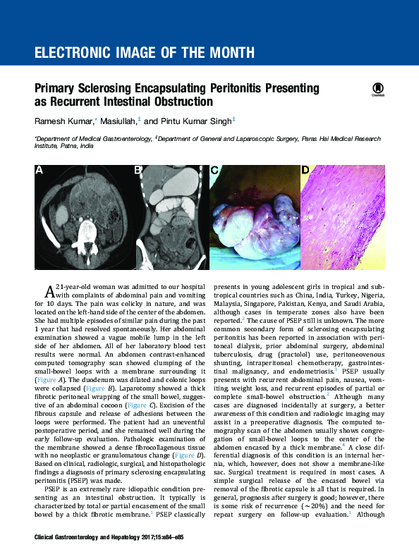 (PDF) Primary Sclerosing Encapsulating Peritonitis Presenting as ...