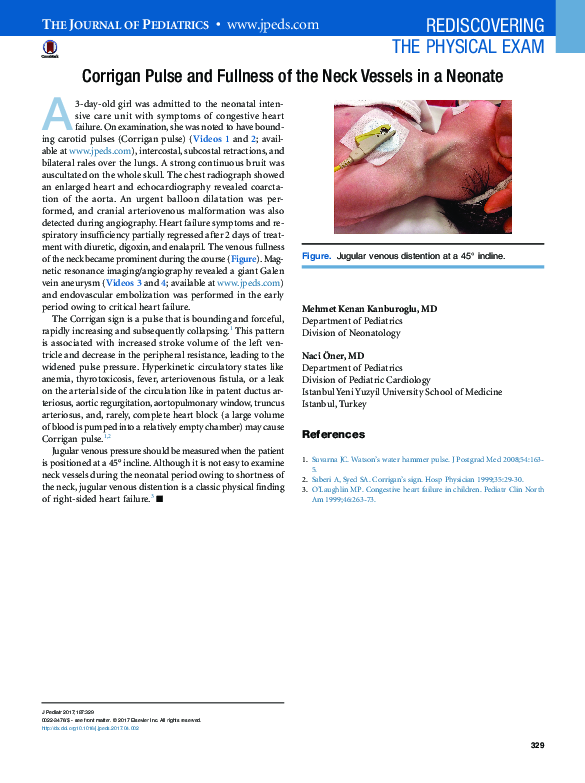 (PDF) Corrigan Pulse and Fullness of the Neck Vessels in a Neonate