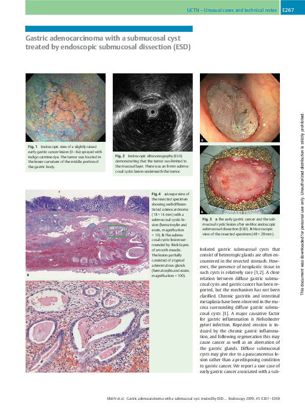 (PDF) Gastric adenocarcinoma with a submucosal cyst treated by ...