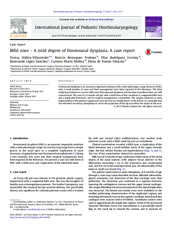 (PDF) Bifid nose – A mild degree of frontonasal dysplasia. A case report