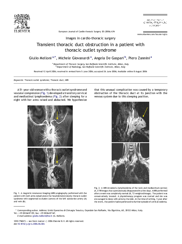 (PDF) Transient thoracic duct obstruction in a patient with thoracic ...
