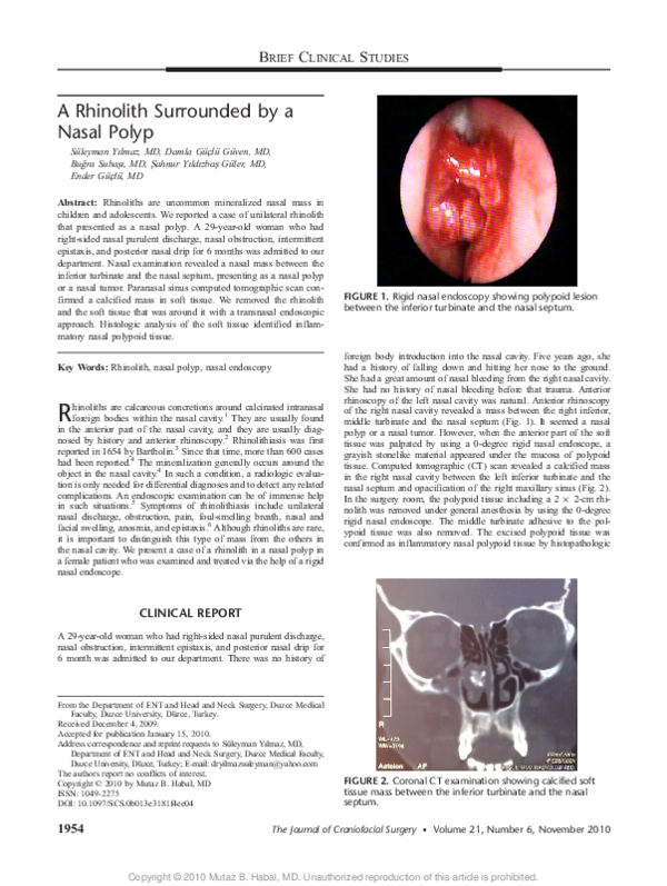 (PDF) A Rhinolith Surrounded by a Nasal Polyp