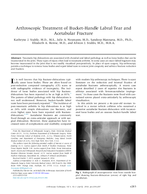 (PDF) Arthroscopic Treatment of Bucket-Handle Labral Tear and ...