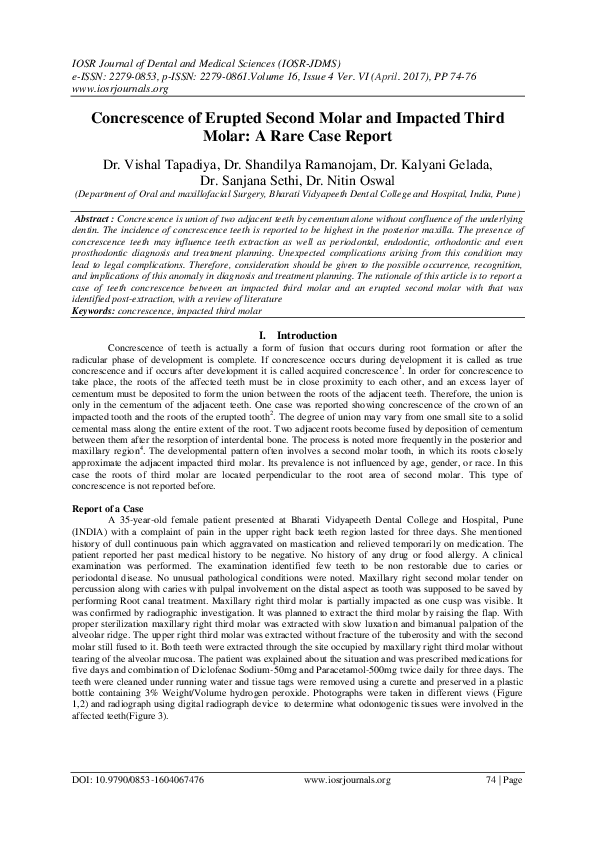 (PDF) Concrescence of Erupted Second Molar and Impacted Third Molar: A ...