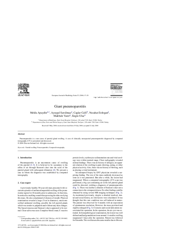 (PDF) Giant pneumoparotitis