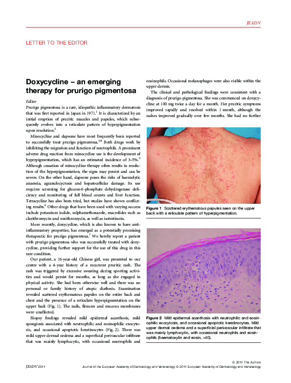 (PDF) Doxycycline - an emerging therapy for prurigo pigmentosa