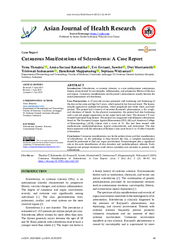 Pdf Cutaneous Manifestations Of Scleroderma A Case Report
