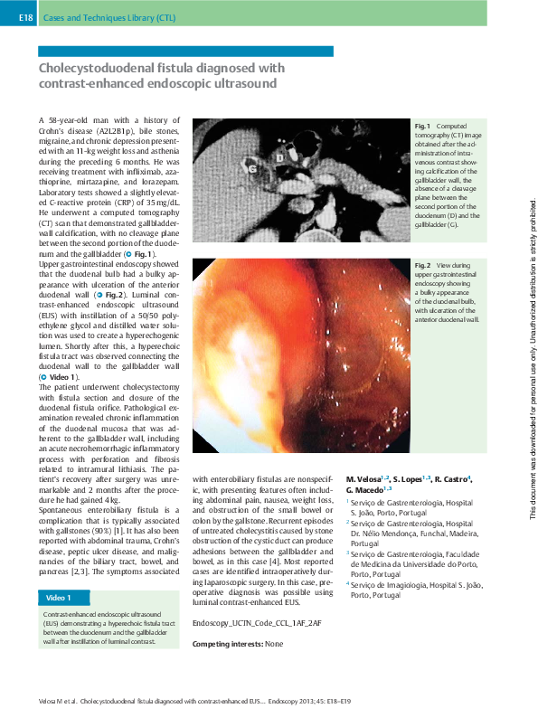 (PDF) Cholecystoduodenal fistula diagnosed with contrast-enhanced ...