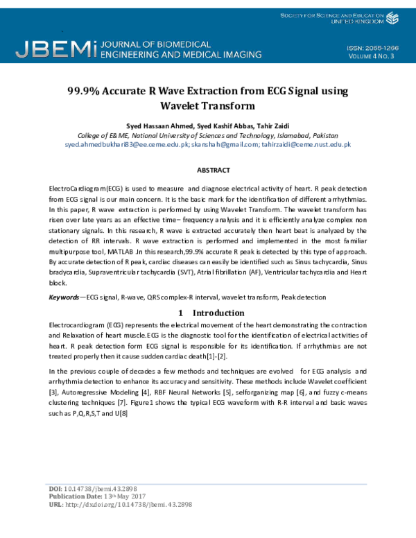 Pdf 99 9 Accurate R Wave Extraction From Ecg Signal Using Wavelet