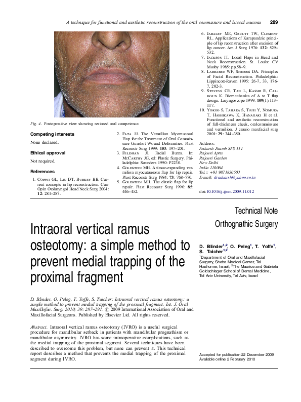 (PDF) Intraoral vertical ramus osteotomy: a simple method to prevent ...