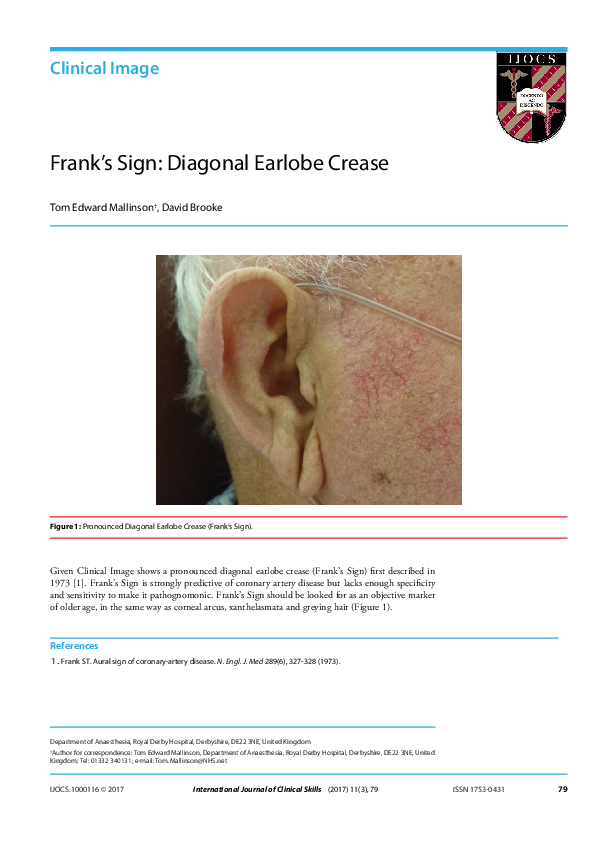 (PDF) Frank's Sign: Diagonal Earlobe Crease