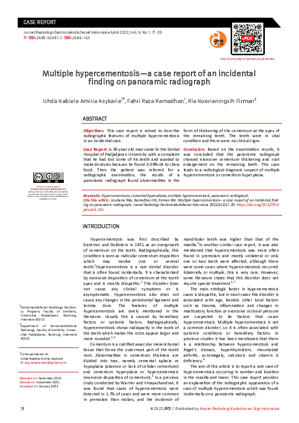 (PDF) Multiple hypercementosis – a case report of an incidental finding ...