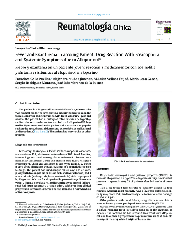 (PDF) Fever and Exanthema in a Young Patient: Drug Reaction With ...