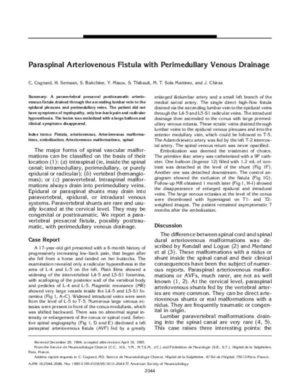(PDF) Paraspinal arteriovenous fistula with perimedullary venous drainage