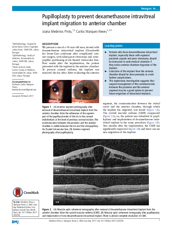 (PDF) Pupilloplasty to prevent dexamethasone intravitreal implant ...