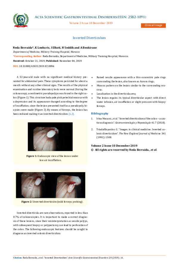 (PDF) Inverted Diverticulum