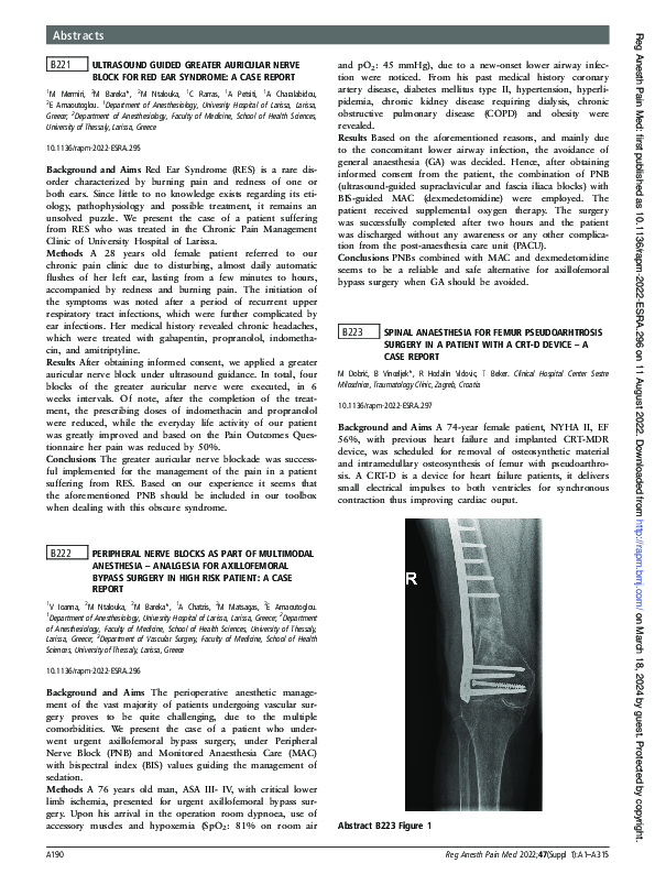 (PDF) B222 Peripheral nerve blocks as part of multimodal anesthesia ...