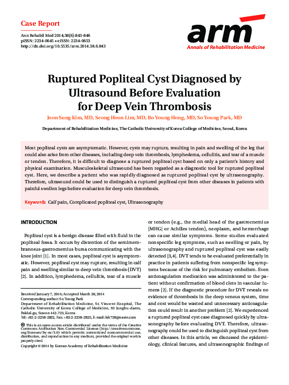 (PDF) Ruptured popliteal cyst diagnosed by ultrasound before evaluation ...