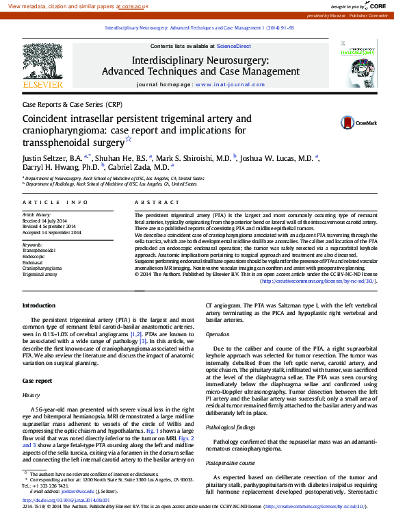 (PDF) Coincident intrasellar persistent trigeminal artery and ...