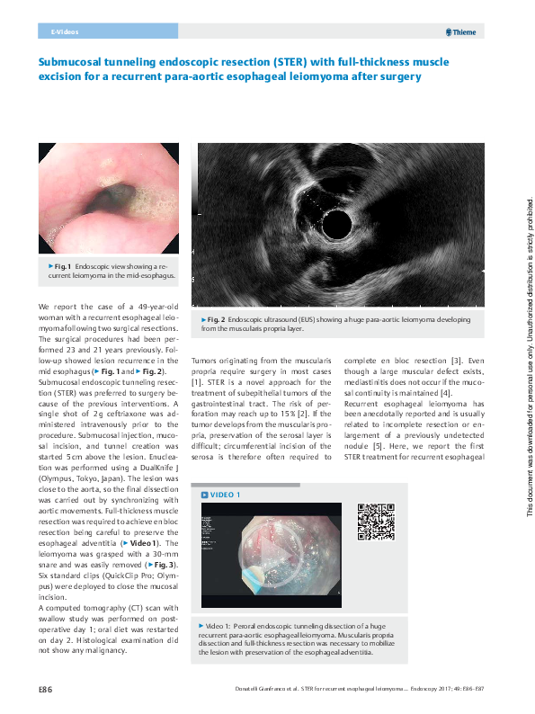 (PDF) Submucosal tunneling endoscopic resection (STER) with full ...