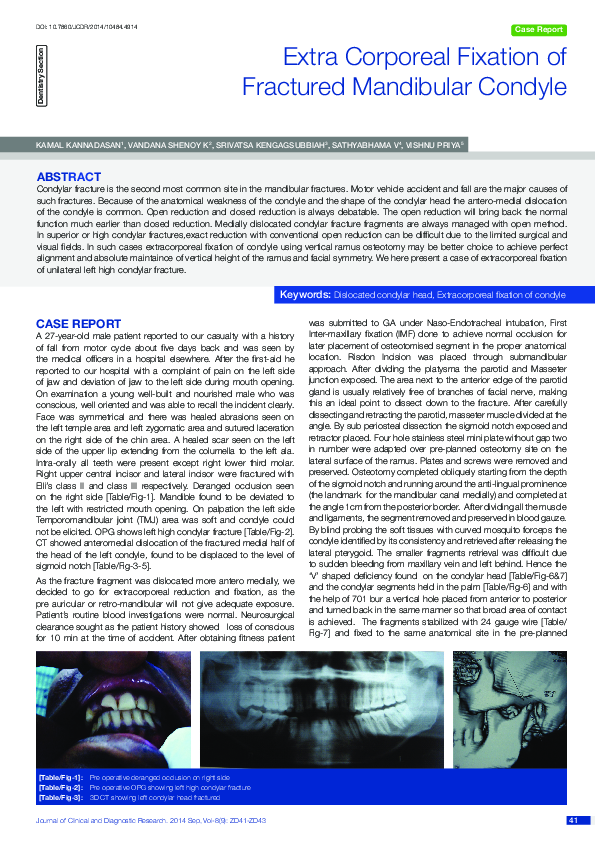 (PDF) Extra corporeal fixation of fractured mandibular condyle