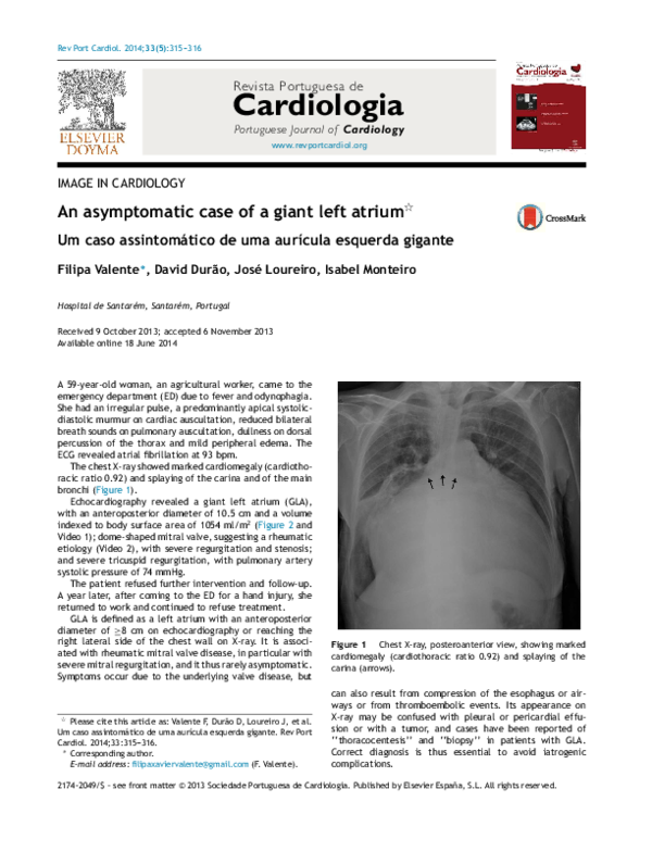 (PDF) An asymptomatic case of a giant left atrium | José Loureiro ...