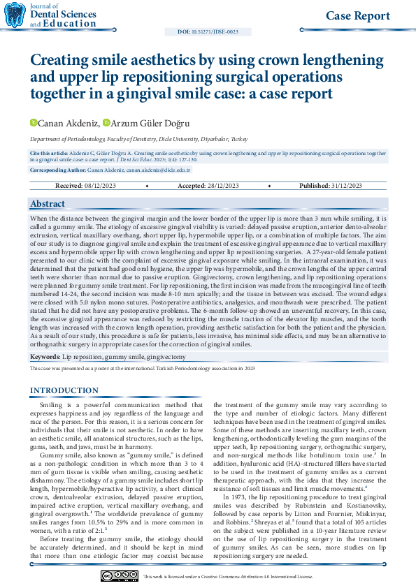 (PDF) Creating smile aesthetics by using crown lengthening and upper ...