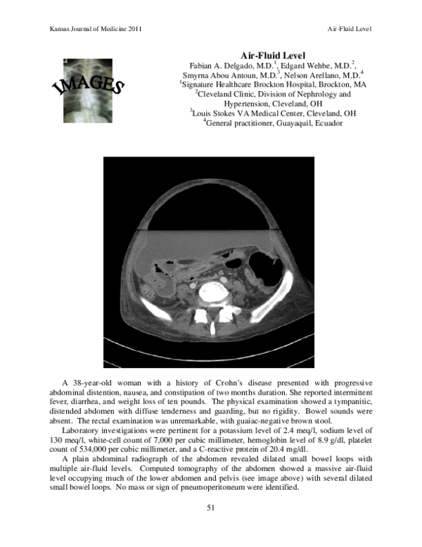 (PDF) Air-Fluid Level