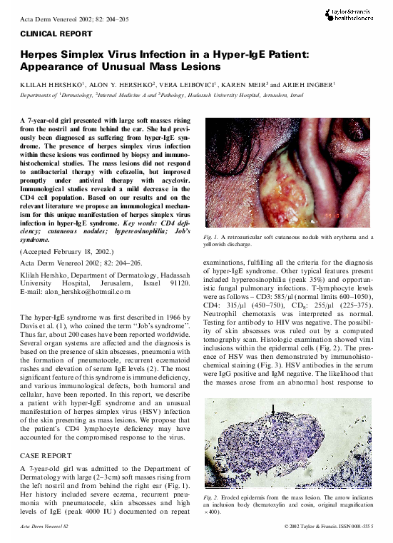 (PDF) Herpes Simplex Virus Infection in a Hyper-IgE Patient: Appearance ...