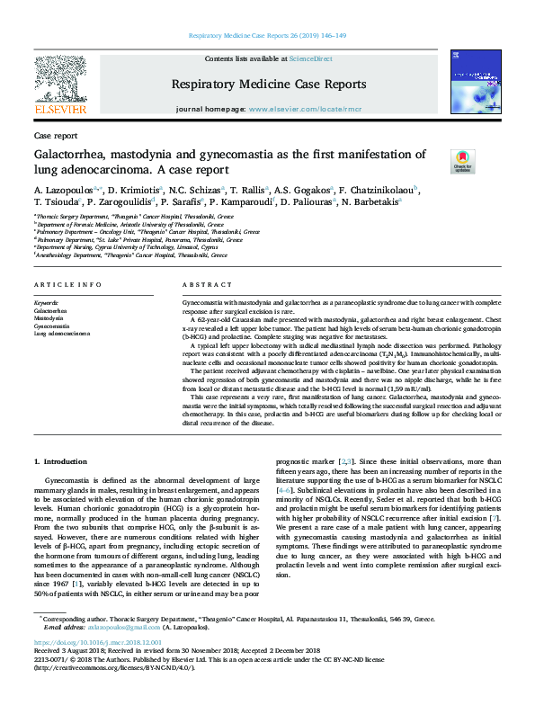 (PDF) Galactorrhea, mastodynia and gynecomastia as the first ...