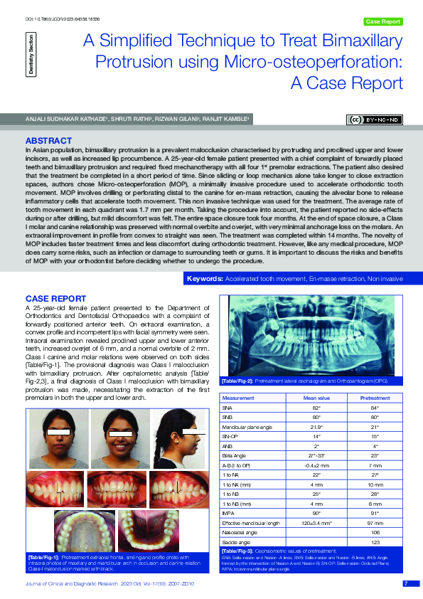 (PDF) A Simplified Technique to Treat Bimaxillary Protrusion using ...
