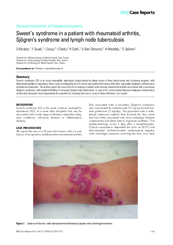(PDF) Sweet's syndrome in a patient with rheumatoid arthritis, Sjogren ...