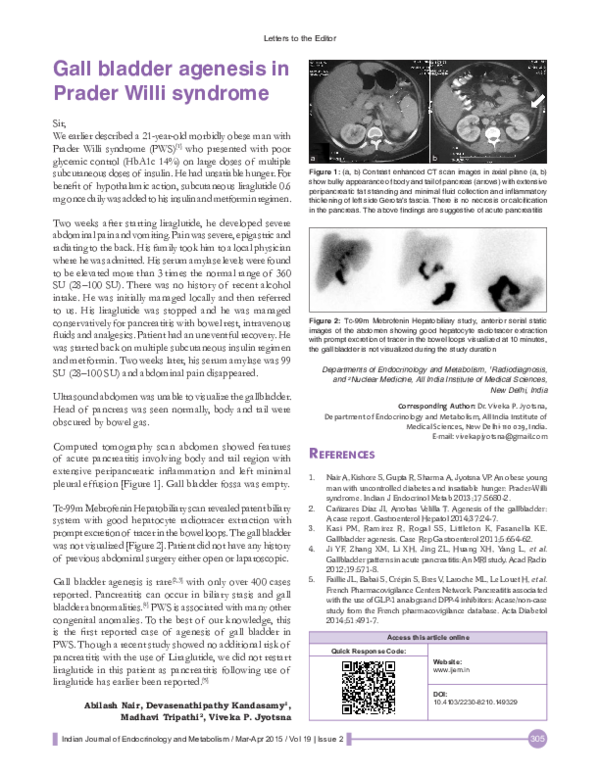 (PDF) Gall bladder agenesis in Prader Willi syndrome