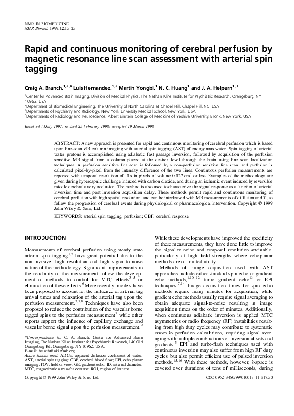 Rapid and continuous monitoring of cerebral perfusion by magnetic ...