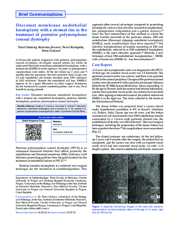 (PDF) Descemet membrane endothelial Keratoplasty with cornea press ...