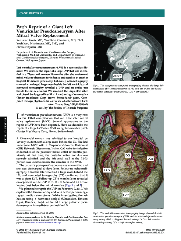 (PDF) Patch Repair of a Giant Left Ventricular Pseudoaneurysm After ...