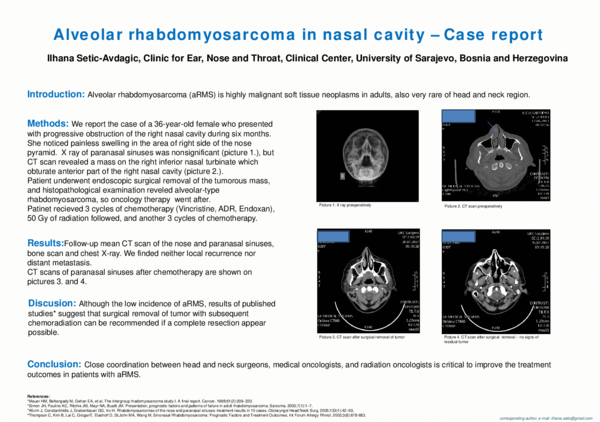 (PDF) Alveolar Rhabdomyosarcoma in Nasal Cavity – Case Report