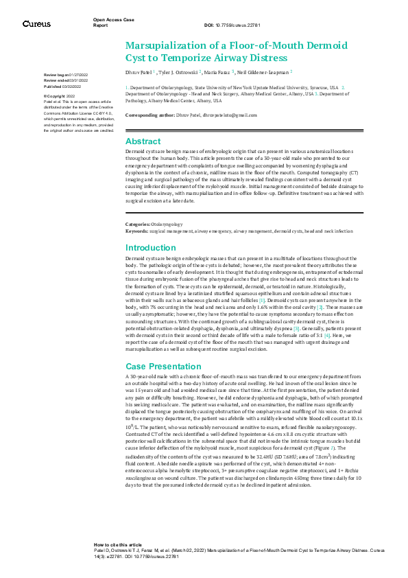 (PDF) Marsupialization of a Floor-of-Mouth Dermoid Cyst to Temporize ...