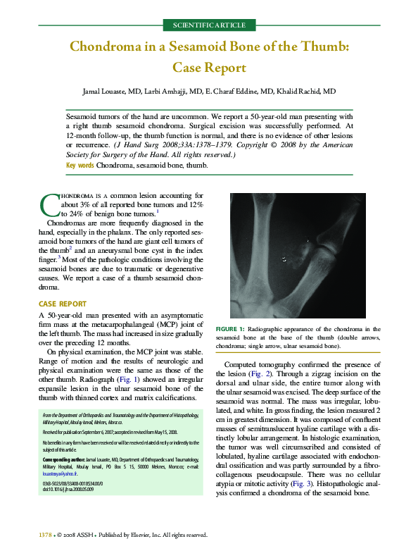 (PDF) Chondroma in a Sesamoid Bone of the Thumb: Case Report