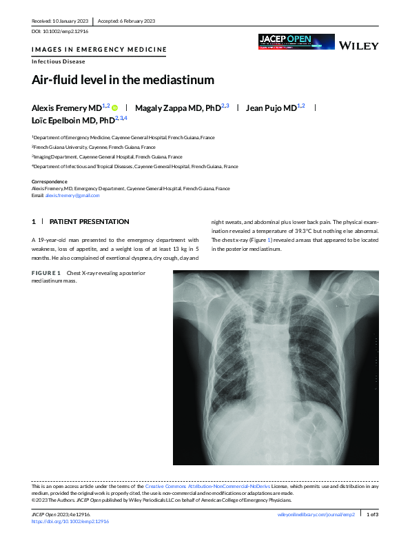 (PDF) Air‐fluid level in the mediastinum