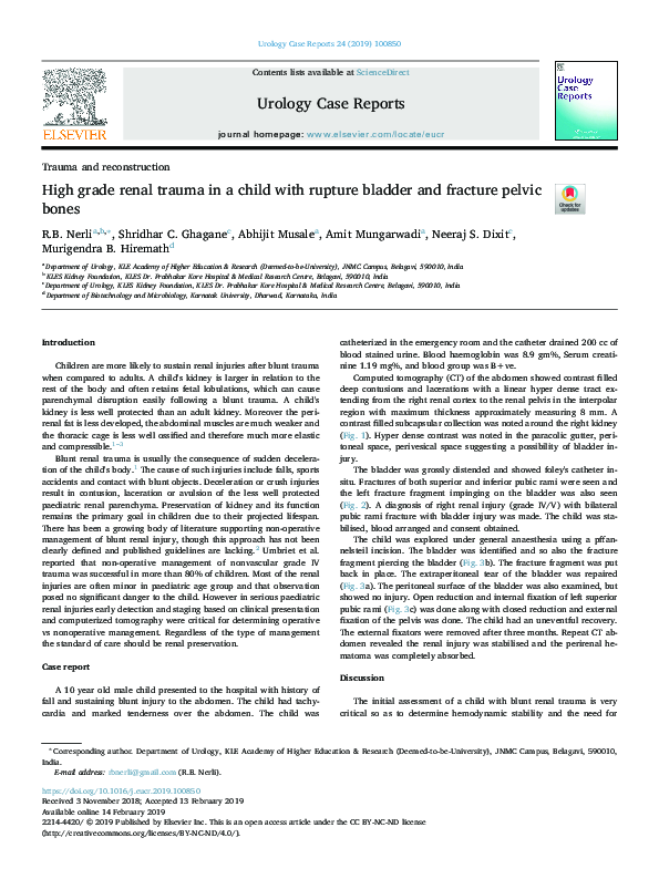 (PDF) High grade renal trauma in a child with rupture bladder and ...