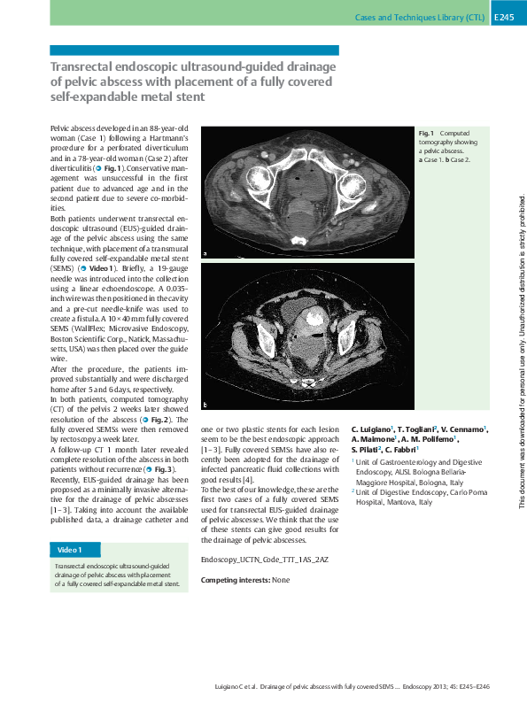 (PDF) Transrectal endoscopic ultrasound-guided drainage of pelvic ...