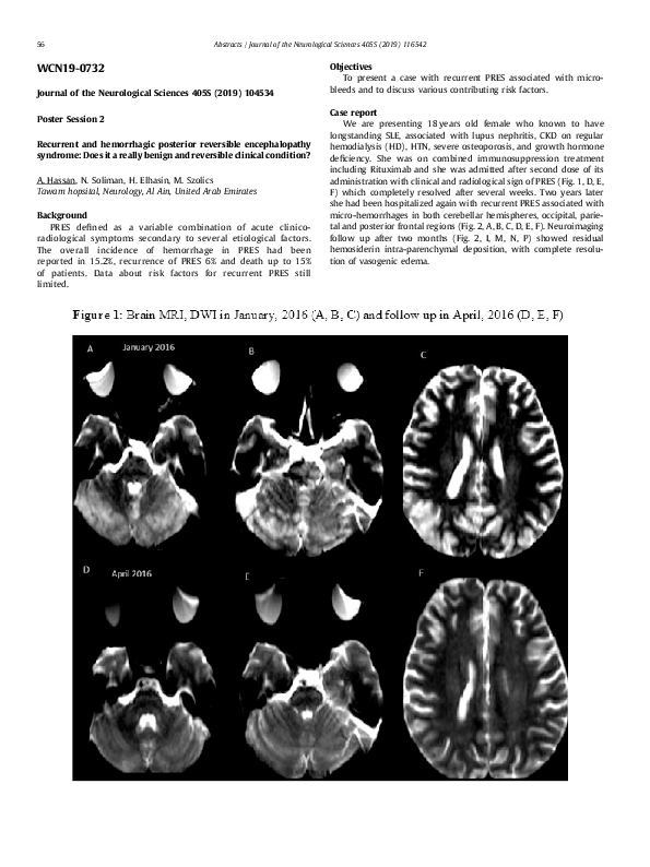 (PDF) Recurrent and hemorrhagic posterior reversible encephalopathy ...