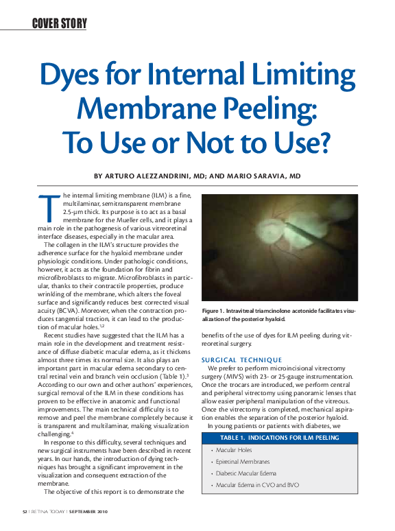 (PDF) Dyes for Internal Limiting Membrane Peeling: To Use or Not to Use?