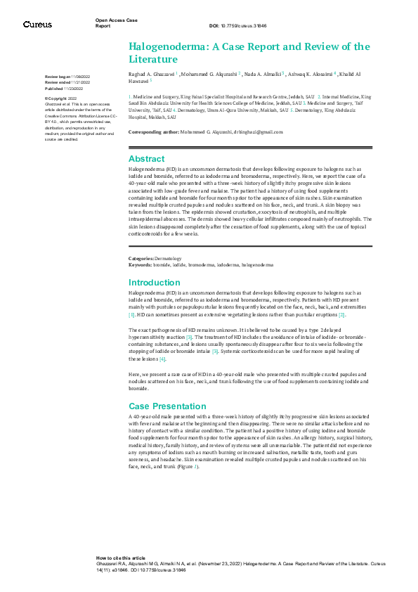 (PDF) Halogenoderma: A Case Report and Review of the Literature