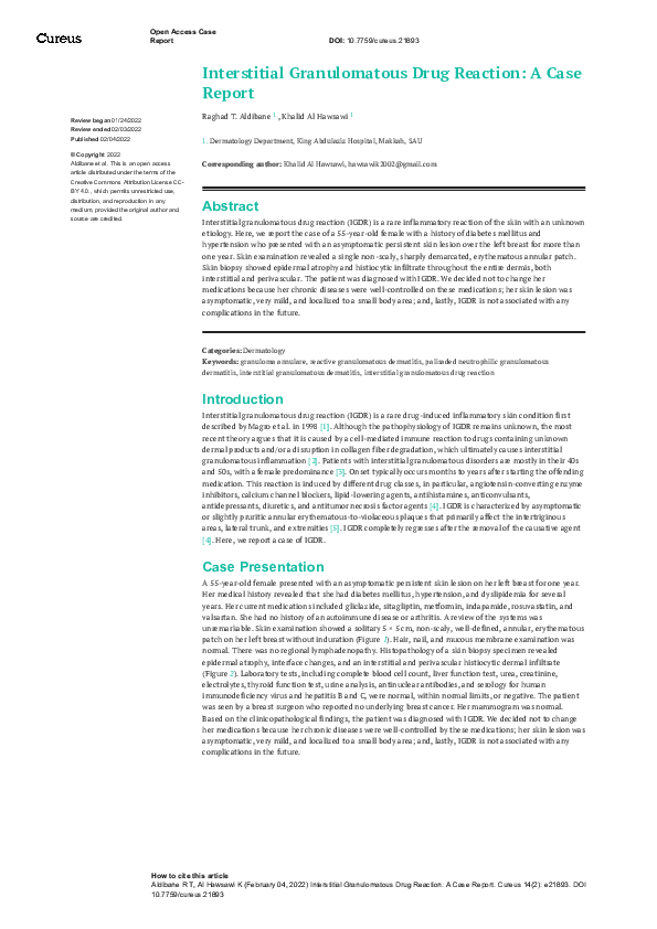 (PDF) Interstitial Granulomatous Drug Reaction: A Case Report
