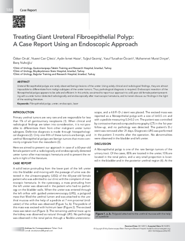 (PDF) Treating Giant Ureteral Fibroepithelial Polyp: A Case Report ...