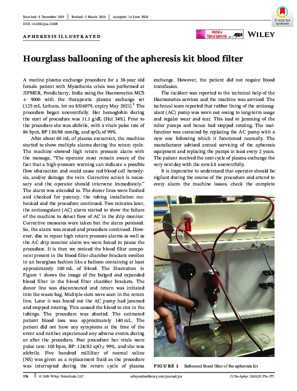 (PDF) Hourglass ballooning of the apheresis kit blood filter